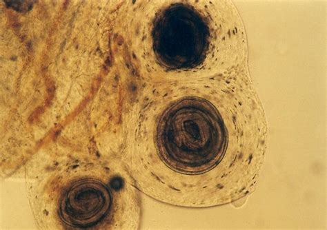 Ascarid Egg In Leopard Gecko Eublepharis Macularius Download