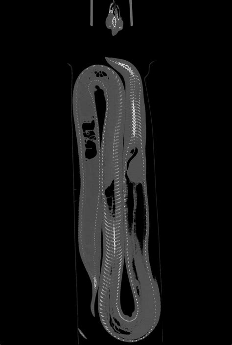 Ct Of A Burmese Python Python Bivittatus