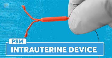 Intrauterine Device Types Uses Function And Procedure