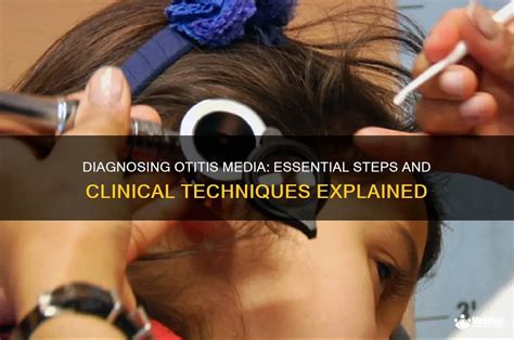 Diagnosing Otitis Media Essential Steps And Clinical Techniques