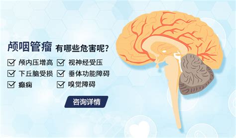 颅咽管瘤 上海蓝十字脑科医院官网 同济大学附属脑科医院筹