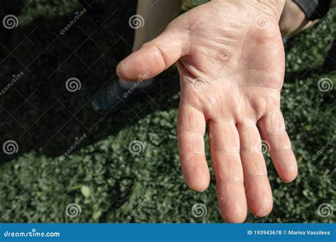 Calluses On The Hands Close Up Of Male Hands Stock Photo Image Of Friendship Female 193943678