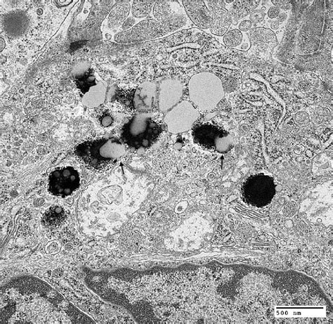 Transmission Electron Micrograph Em Of The Ciliary Body