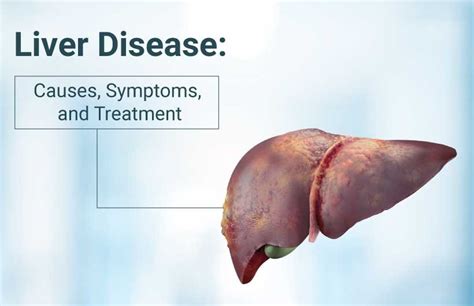 Liver Disease Causes Symptoms And Treatment Dr Varun Bajaj