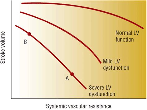 What Is A Normal Lv Function IUCN Water