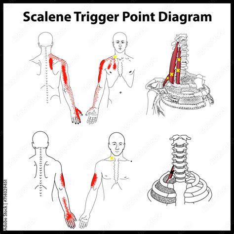 Scalene Trigger Point Vector Diagram Stock Vector Adobe Stock