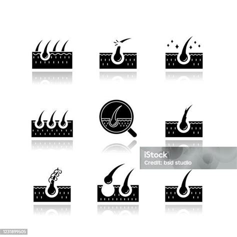 탈모 드롭 그림자 검은 색 문말 아이콘 세트 손상된 모발 건강에 해로운 뿌리 두피와 여포 피부 조직 피부과 치료 헤어 케어 문제 공백에 대한 격리된 벡터 그림 개념에 대한