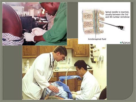 Csf Analysis Presentation Ppt