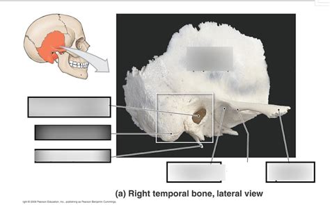Temporal Bone Diagram Quizlet
