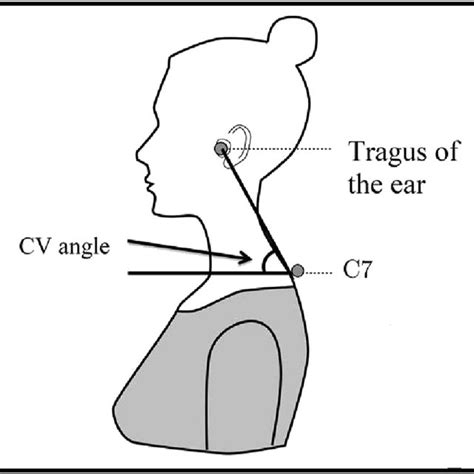 Measurement Of Craniovertebral Angle Download Scientific Diagram