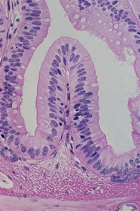 Simple Columnar Epithelium Goblet Cells And Villus Photograph By Ed Reschke