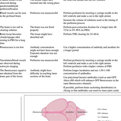 Illustration Of A Mouse Brain And Various Brain Regions In The Slices Download Scientific