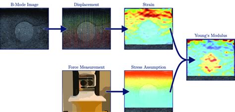 The Workflow Of The Presented Elastography Algorithm With The Basic