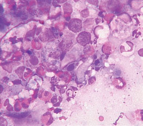 Feline Eosinophilic Granuloma Complexities Laura Buckley Tim