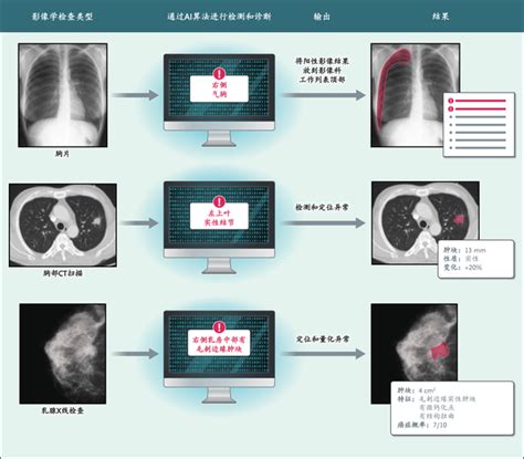 ai 解读医学影像：现状和未来 知乎