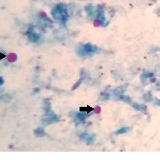 Fecal Smear Stained With Modified Ziehl Neelsen Stain Showing