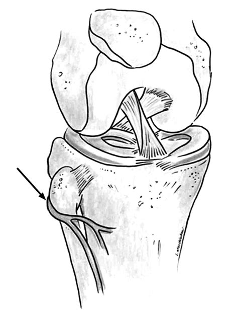 Proximal And Distal Tibiofibular Joint