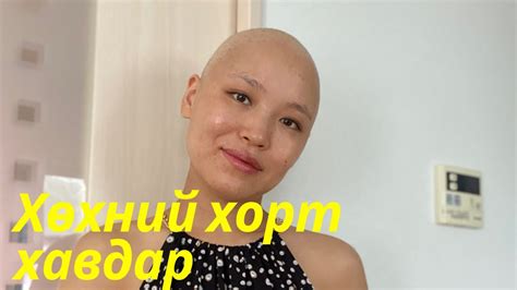 Хөхний хорт хавдар гэдэг онош сонссон Youtube