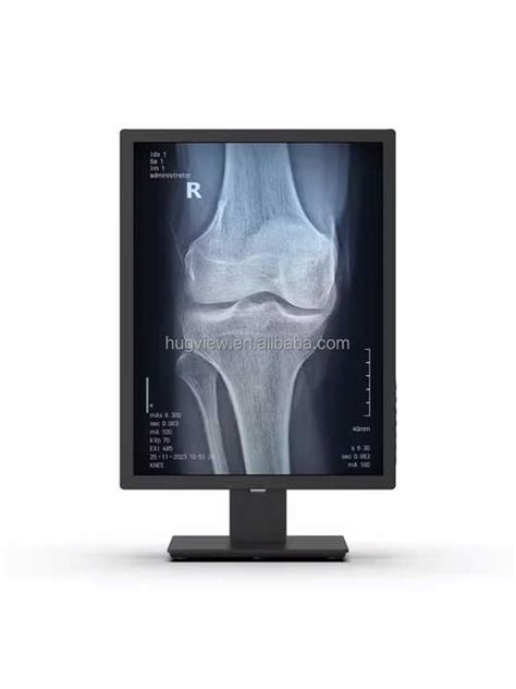 213 Inch 3mega M Vertical Screen For Grey Scale Ct Reading