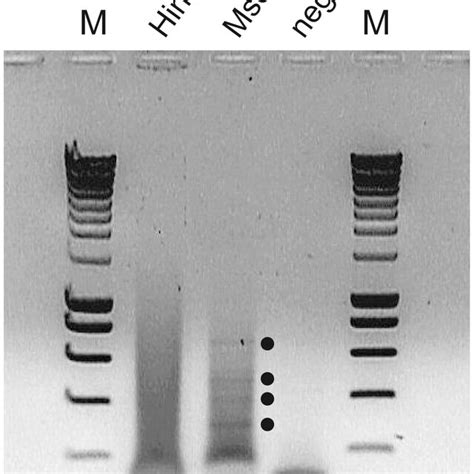 No Decrease In Viral Genome Amplification With Random Hexamers Download Table