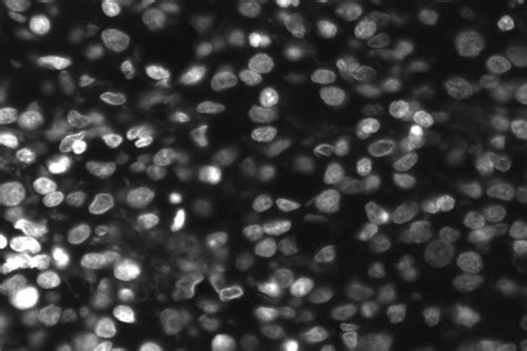 Instance Segmentation Automatic Nucleus Detection By Glib Kechyn Tds Archive Medium