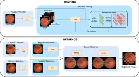 Conked Multiview Contrastive Descriptor Learning For Keypoint Based Retinal Image Registration