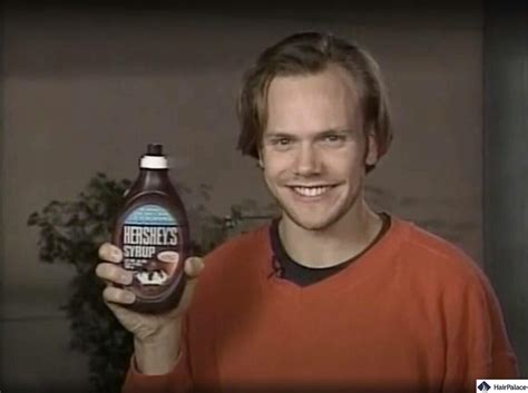 The Joel McHale Hair Transplant Story