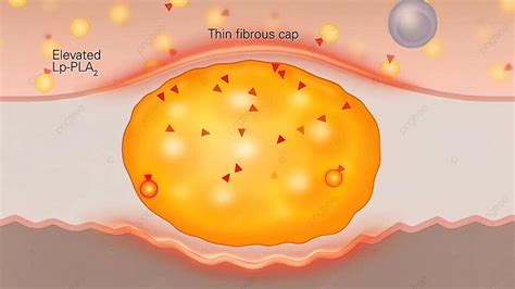 350 Foto Sel Makrofag Gambar Dan Background Untuk Unduh Gratis Pngtree