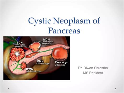 Cystic Neoplasm Of Pancreas Pptx Cystic Neoplasm Of Pancreas Pptx