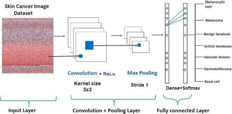 Skin Lesion Classification Using Cnn Model [78] Download Scientific Diagram