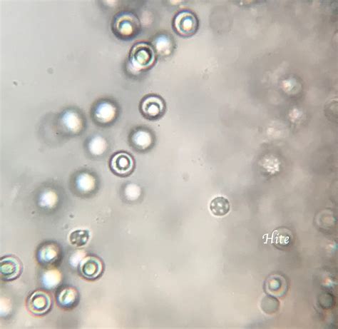 Hites Fish World Dermocystidium