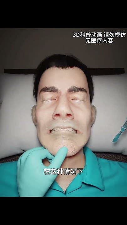 悬雍垂过长 科普知识 人体奥秘 微观世界 科普知识 科普 科普一下 百科密码 知识渊博 大千世界 奇异世界 科普長知識 Youtube