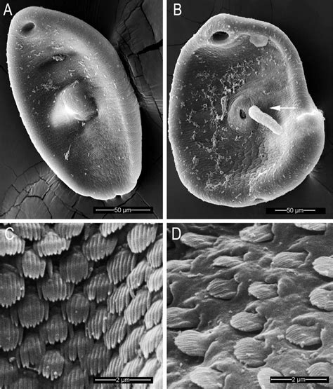 Excysted Metacercaria Of A Maritrema Orensense And B Maritrema Download Scientific Diagram