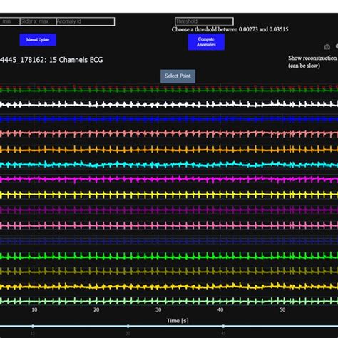Ecg Anomaly Detector And Initial Annotator Tool Interface Download Scientific Diagram