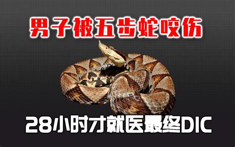18岁男子被五步蛇咬伤！28小时后才就医？最终发展为dic 龙雅不爱吃 龙雅不爱吃 哔哩哔哩视频
