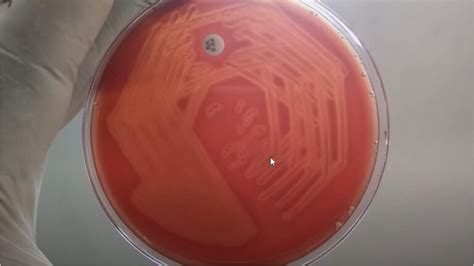L Pyrrolidinyl β Naphthylamide Pyr Test Introduction Principle