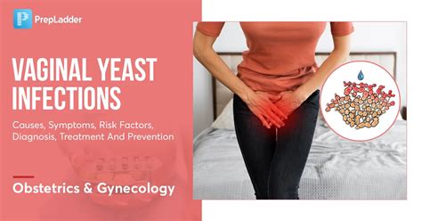 Vaginal Yeast Infections Causes Symptoms Diagnosis And Risk Factors
