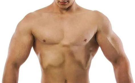 Learn How To Correct Rib Flaring Posture Imbalance With Effective Solutions Emedicodiary