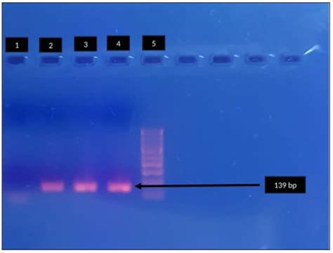 Macrolide And Fluoroquinolone Resistance Associated Mutations In