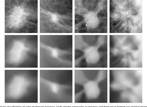 Figure 1 From A Deep Feature Based Framework For Breast Masses Classification Semantic Scholar