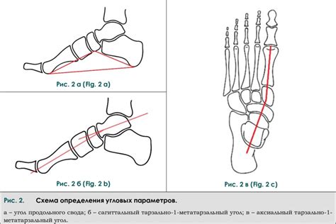 Scheme Of Angular Parameter Determination A Longitudinal Arch Angle