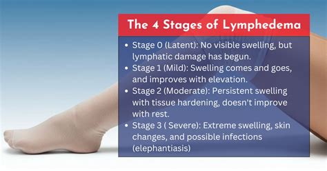 4 Lymphedema Stages Symptoms And Treatments Cgm Monitors