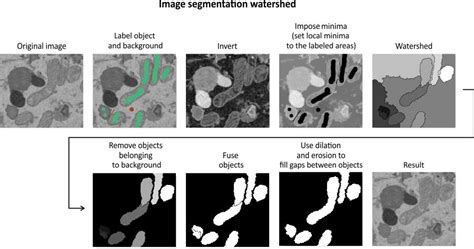 Microscopy Image Browser Watershedgraphcut Segmentation