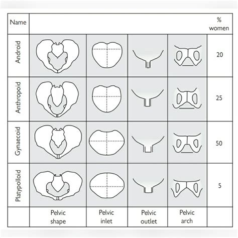 The Female Pelvis Types And Diameter Nurses Note