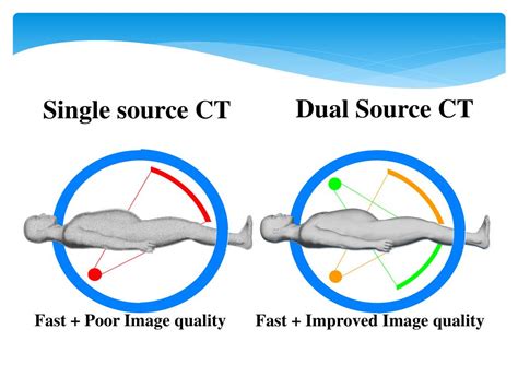 PPT CT Physics And Instrumentation PowerPoint Presentation Free Download ID 1976943