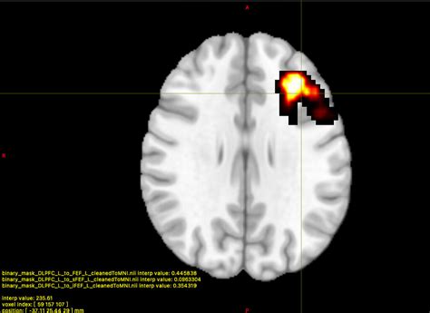 How Does Mrcalc A B Max C Command Process With The Overlapping