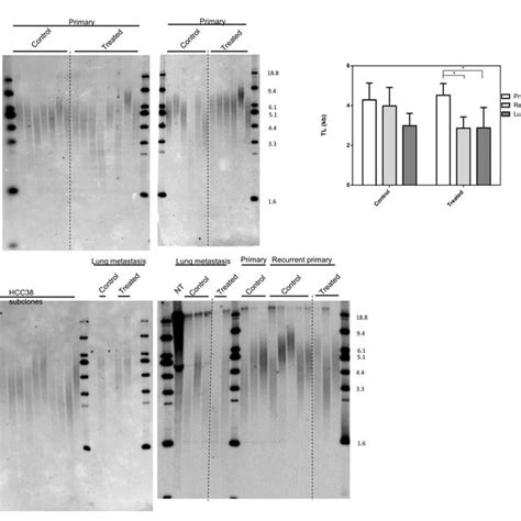 Figure S2 Terminal Restriction Fragment Trf Primary Data For Figure