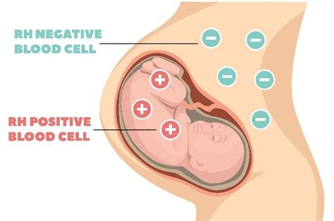10 Frequently Asked Questions About Hemolysis Health And Detox And Vitamins