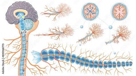 Diagram Of Multiple Sclerosis Showing Demyelination Of Nerve Fibers And Its Impact On Nerve