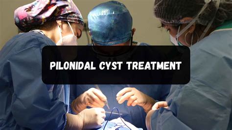 Pilonidal Cyst Faqs Answers Patients Most Common Pilonidal Cyst